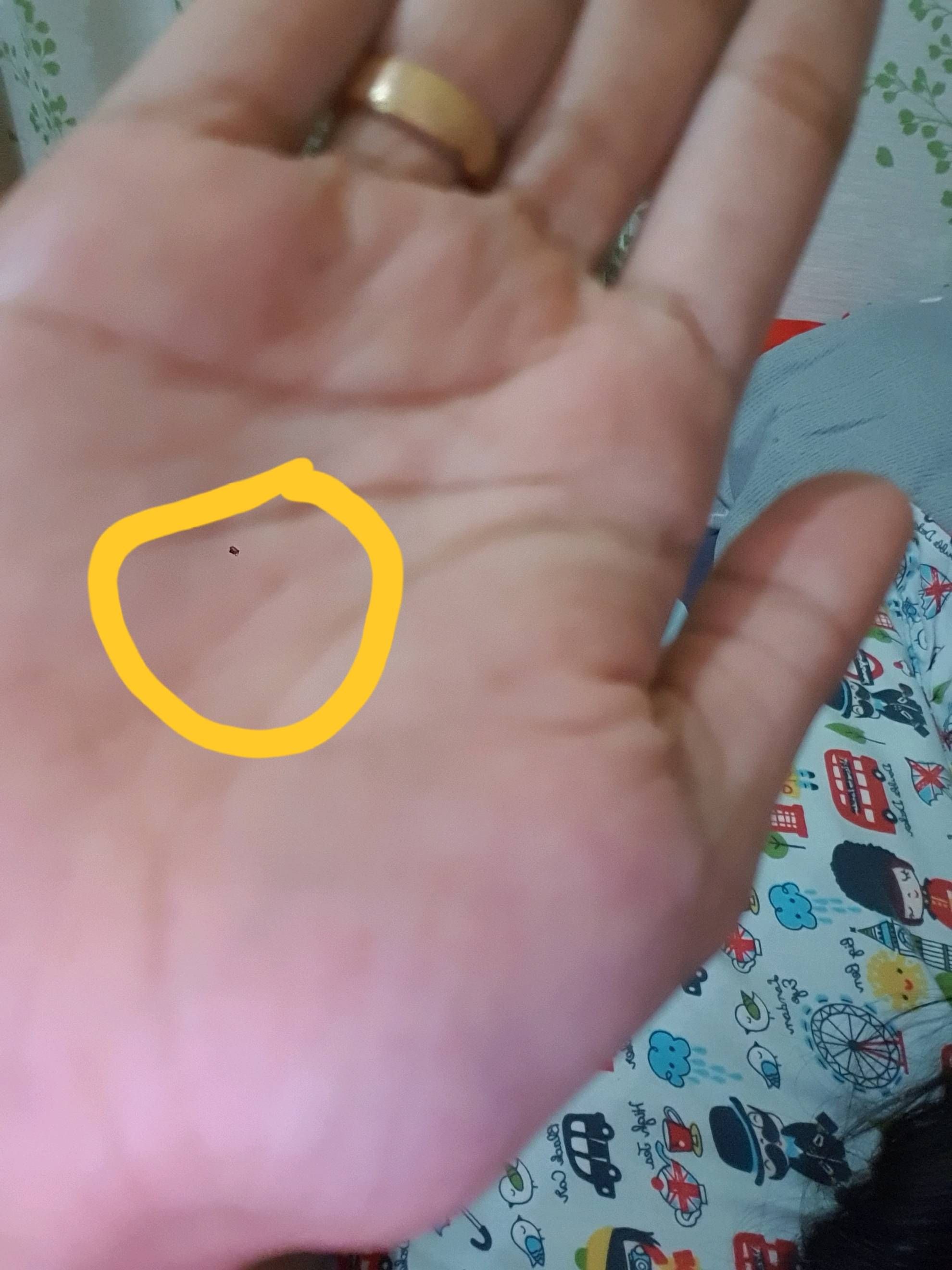 kamera ada tompel - Samsung Members